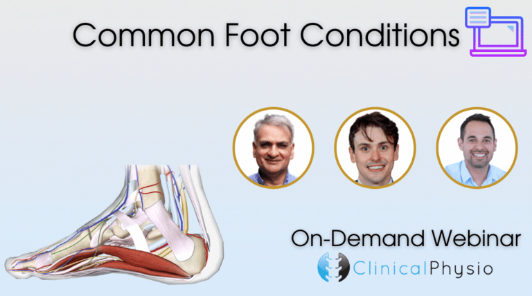 Common Foot Conditions On-Demand Webinar | Clinical Physio Common Foot Conditions On-Demand Webinar | Clinical Physio