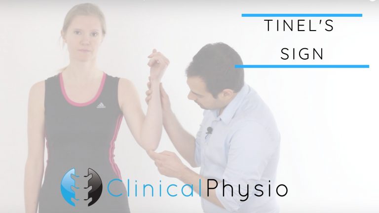 Cozen's Test | Clinical Physio