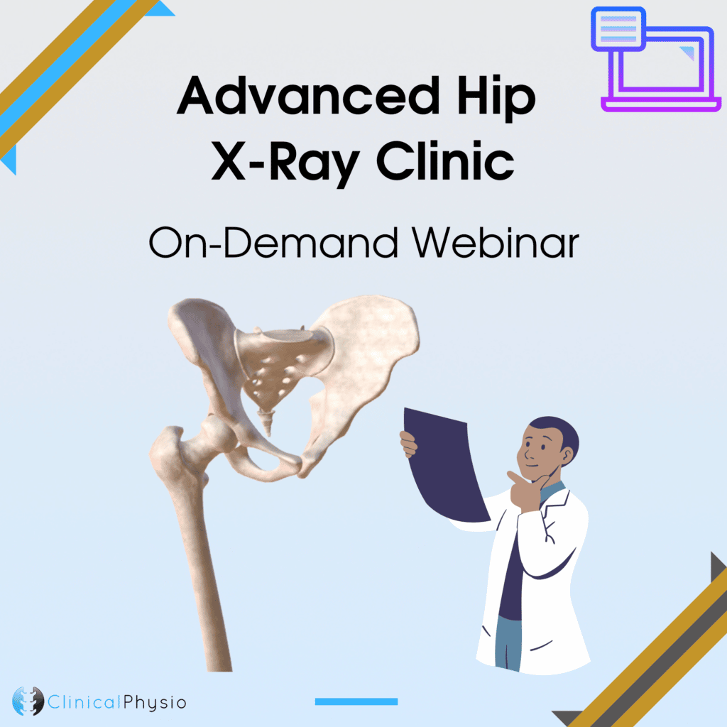Advanced Hip X-Ray Clinic On-Demand Webinar | Clinical Physio