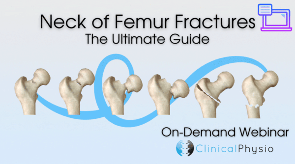 Neck of Femur Fractures The Ultimate Guide | Clinical Physio