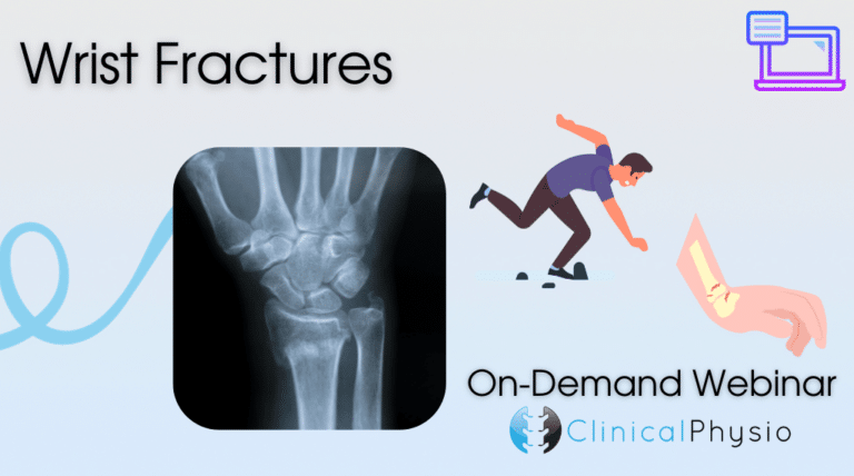 Wrist Fractures | Clinical Physio