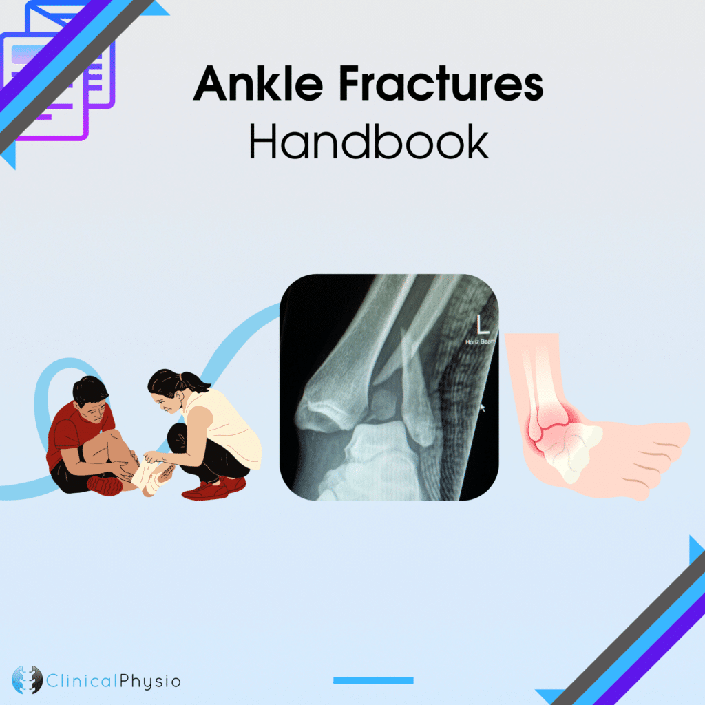 Ankle Fractures Handbook | Clinical Physio
