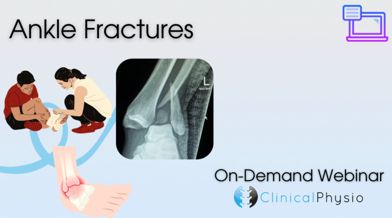Ankle Fractures | Clinical Physio