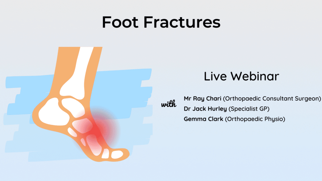 Foot Fractures | Clinical Physio