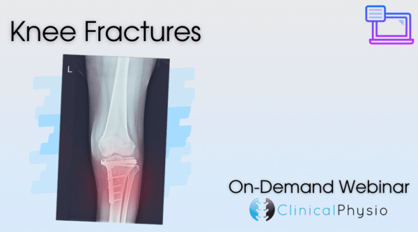 Knee Fractures | Clinical Physio