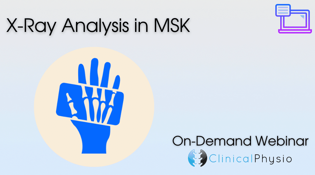 X-Ray Analysis in MSK | Clinical Physio