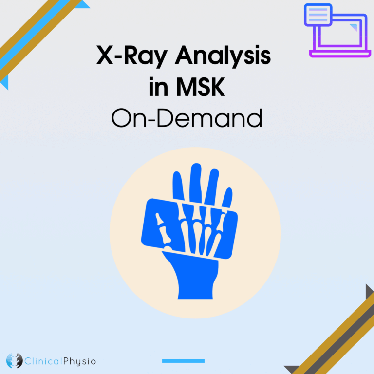 X-Ray Analysis in MSK On-Demand Webinar | Clinical Physio
